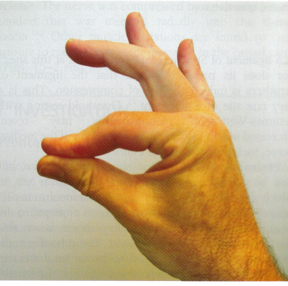 A Framework for Advanced Upper Extremity Practice: Integrated ...
